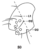Pyraloidea Larvae Key Couplet 39 : USDA ARS